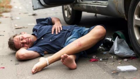 Fracturas En Accidentes De Tráfico Diccionario Vial Tuteorica